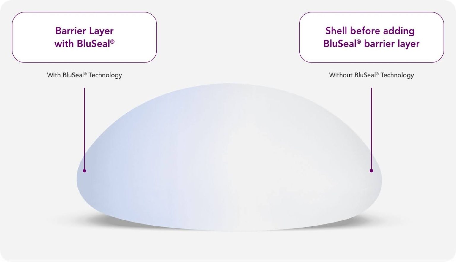 Now Offering Motiva® Breast Implants in Fort Worth - Kirby Plastic Surgery